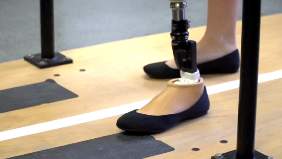 New help for SA amputees | WOAI