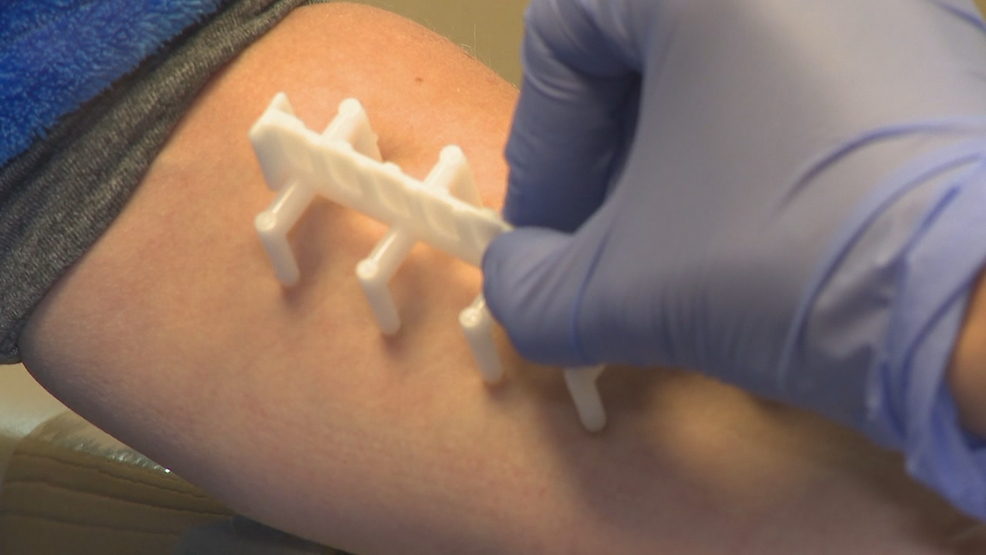 Allergy shots could be the solution for seasonal allergy sufferers | KATV